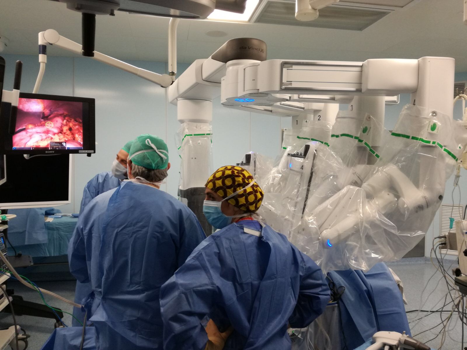 Chirurgia robotica, Terni all’avanguardia | umbriaON Chirurgia robotica, Terni all’avanguardia | umbriaON